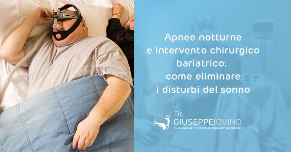 Apnee notturne e intervento chirurgico bariatrico: come eliminare i ...